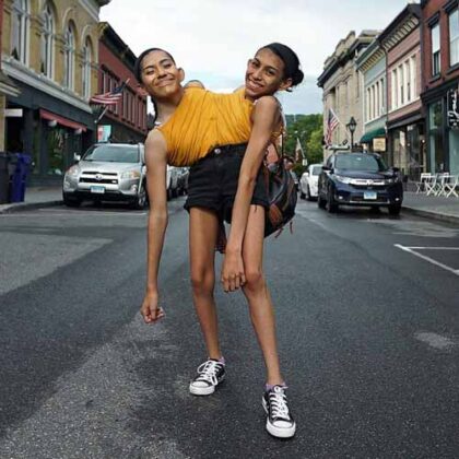 We Decide Relationship Outings Individually, Conjoined Twins Open Up On ...