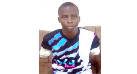 20-Year-Old Man Seeks Justice After Uncle Chops Off His Hands Over ...